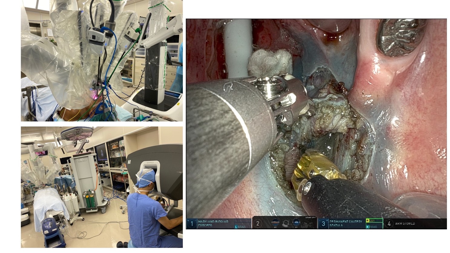 Head and Neck Surgery｜ATLAS Asia Clinical Trials Network for Cancers ...